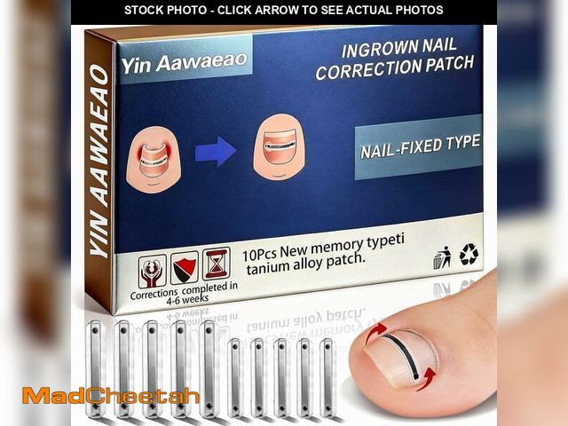 MadCheetah.com - Lot 74-13833907 - Titanium Alloy Ingrown Toenail ...