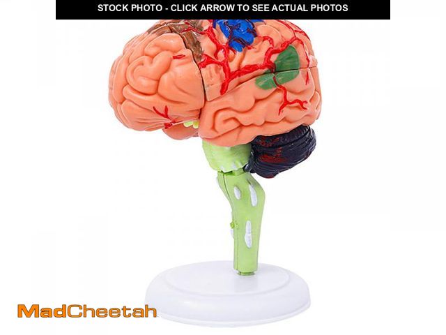 MadCheetah.com - Lot 74-11984029 - Small Human Brain Model for Anatomy ...
